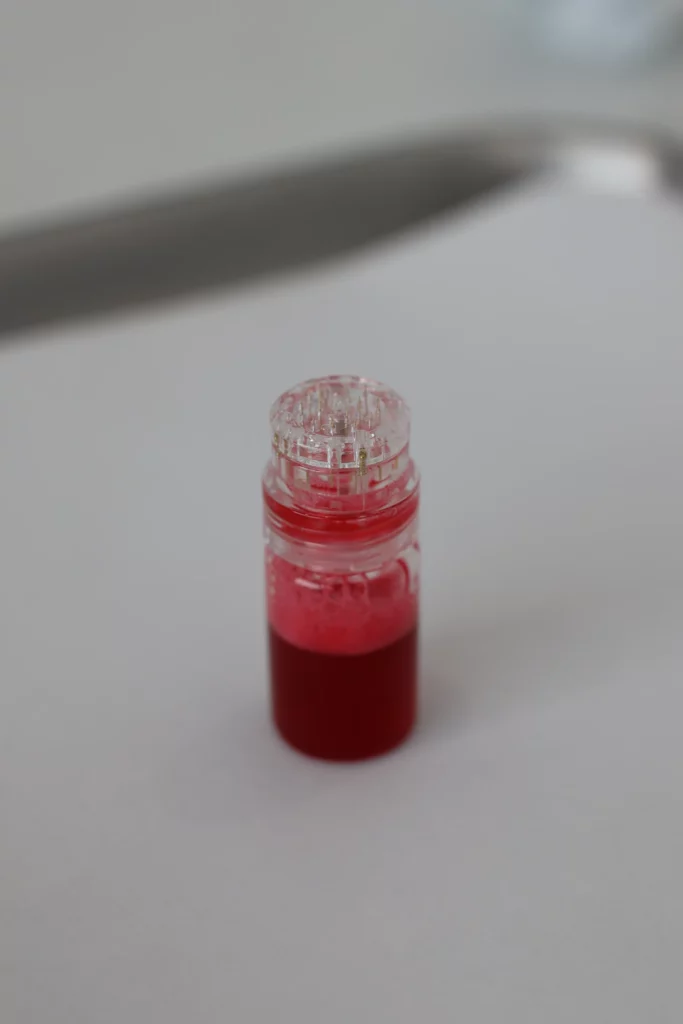 MK Gold | Best Microchanneling Treatment in Orlando, FL